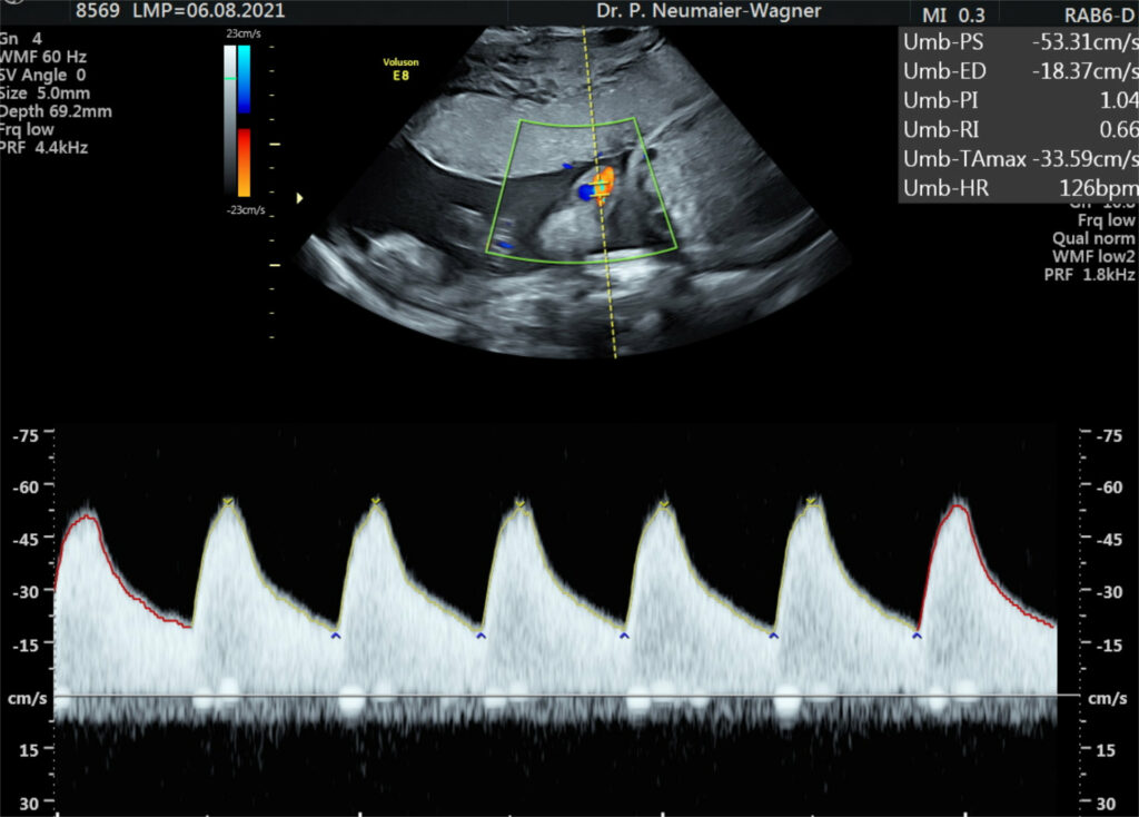 Pränatale Diagnostik – Frauenärztin Theresienwiese